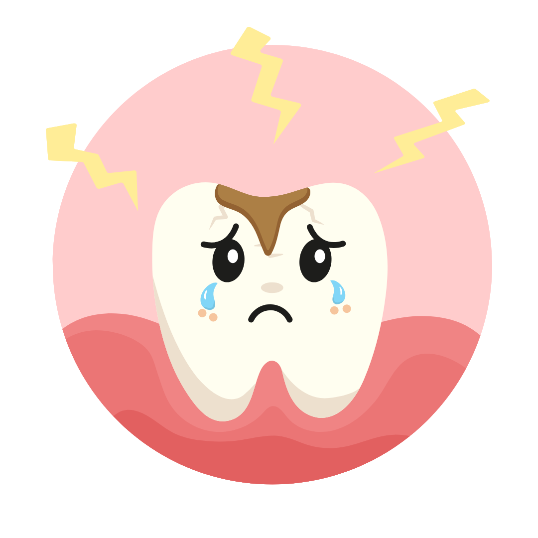 What are cavities? A Kid-Friendly Answer